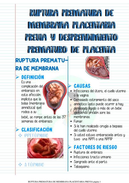 Ruptura prematura de membrana placentaria previa | Antonella Rivadeneyra Ramirez | uDocz