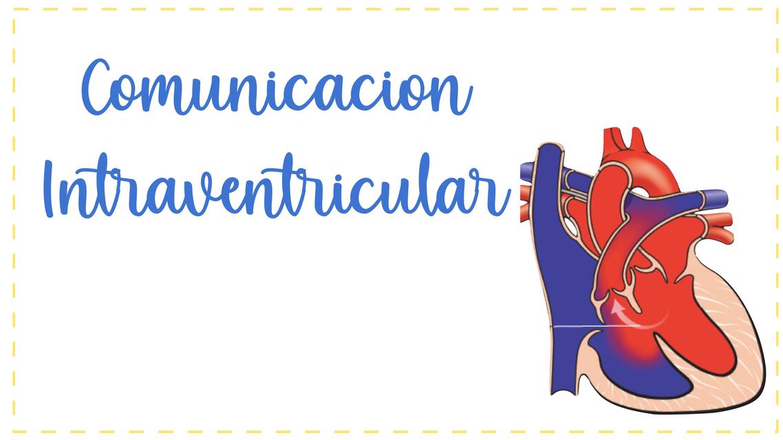 Comunicacion Interventricular Civ Indicaciones Qx Pics Medicine 馃専