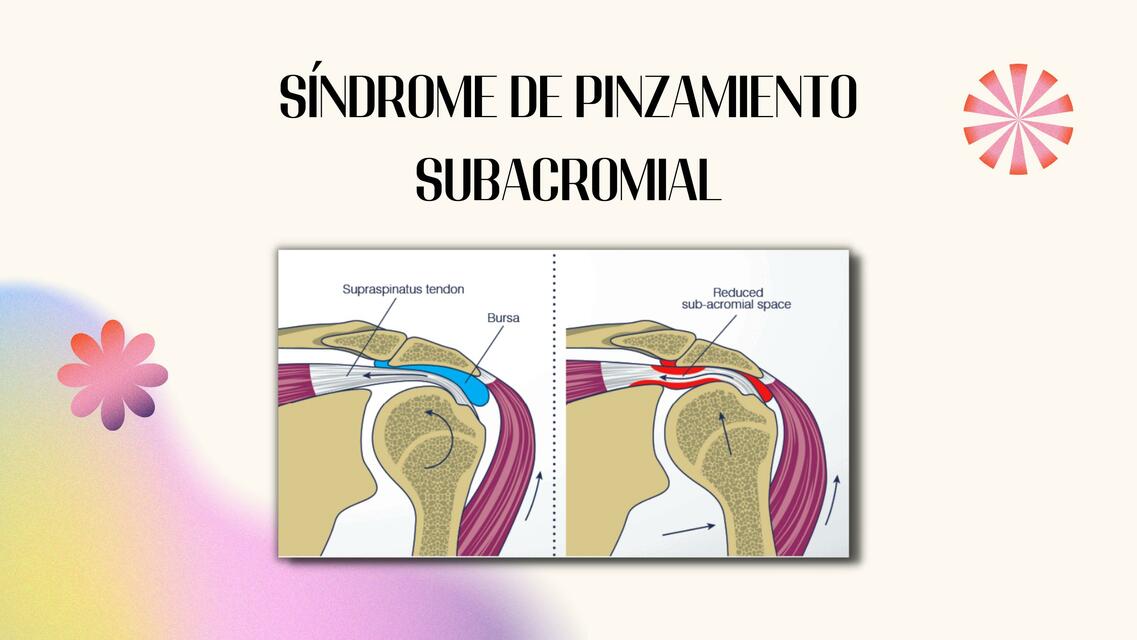 Pinzamiento Subacromial - Generalidades | Physio Studies | uDocz