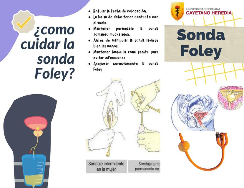 Sonda foley | Nursing_assist4nce | uDocz