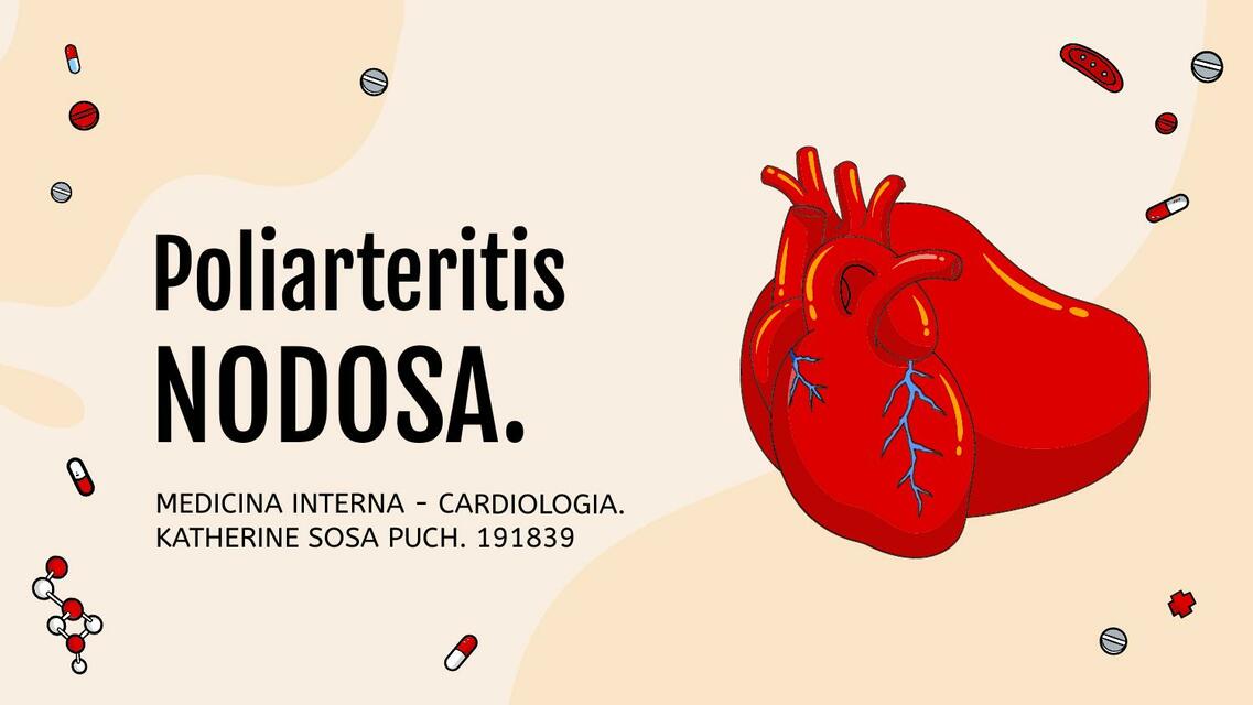 Poliarteritis nodosa | Katherine Sosa | uDocz
