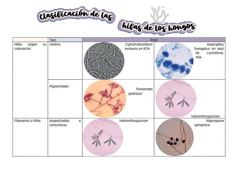Clasificación de las hifas de los hongos | Ranita Cientifica | uDocz