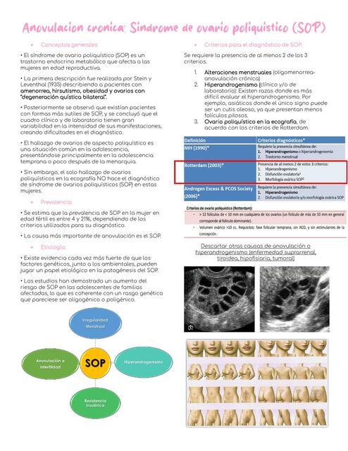 Síndrome de Ovario Poliquístico (SOP) | Catalina Rojas Rodríguez | uDocz