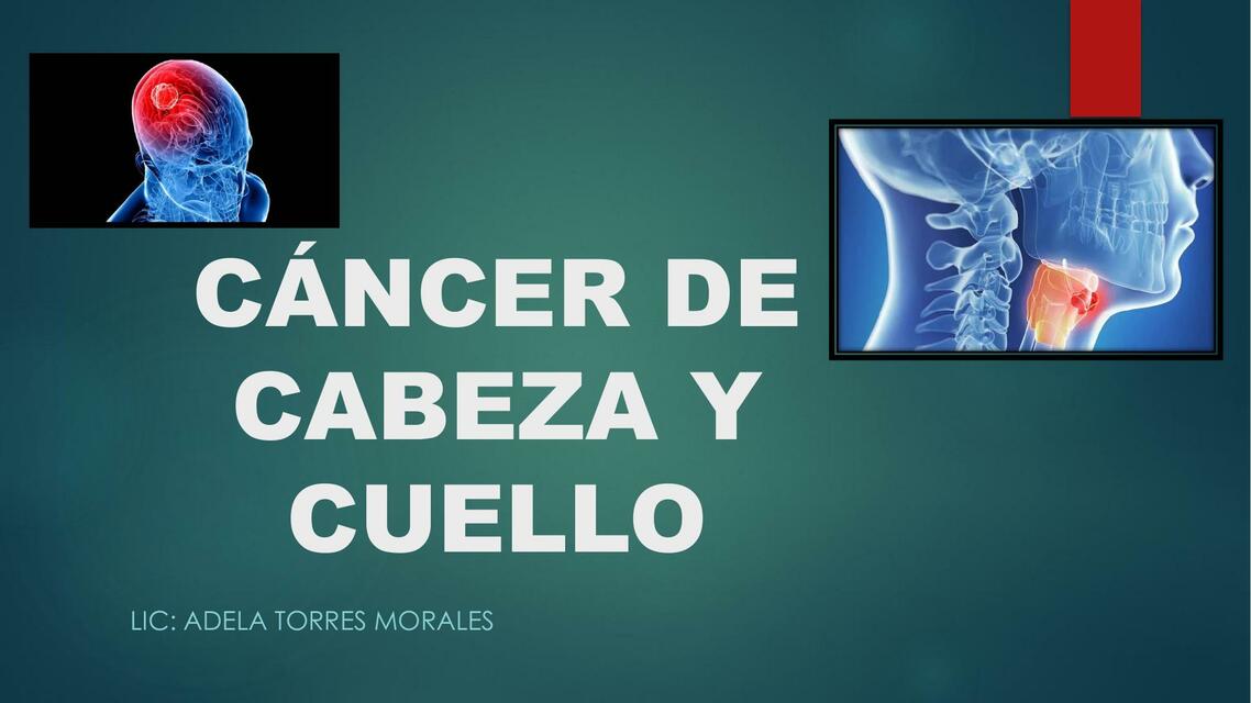 CANCER DE CABEZA Y CUELLO | Estherestefani Ore | uDocz