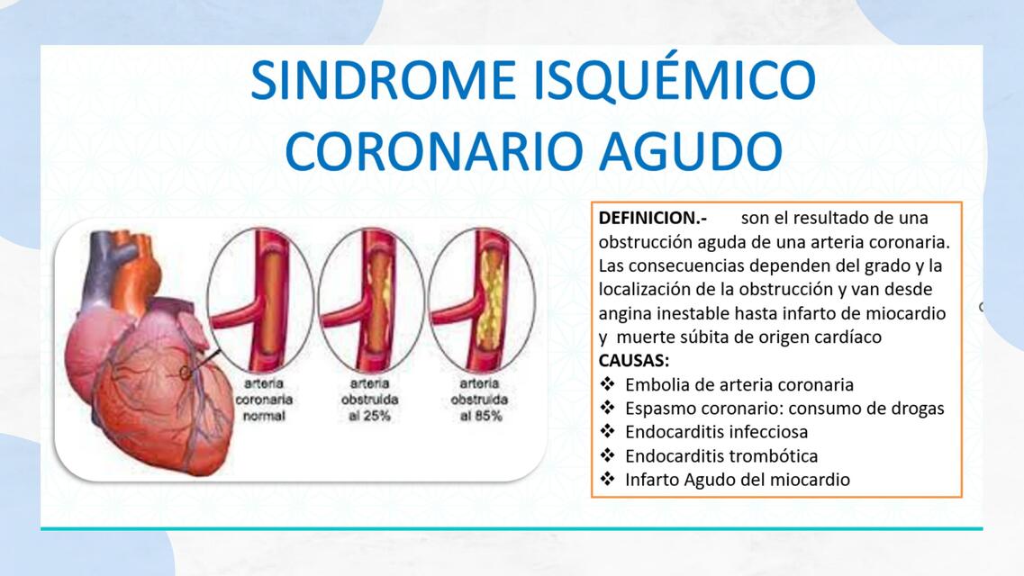Sindrome Isquemico Coronario Agudo | Alxnsx s | uDocz
