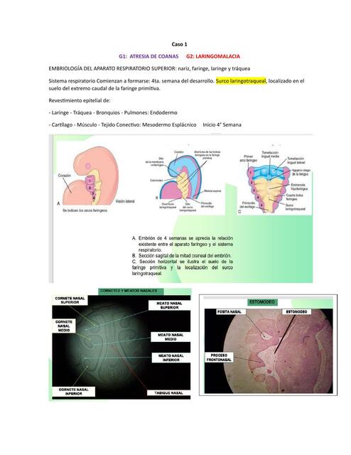 Atresia de Coanas | Lesmil | uDocz