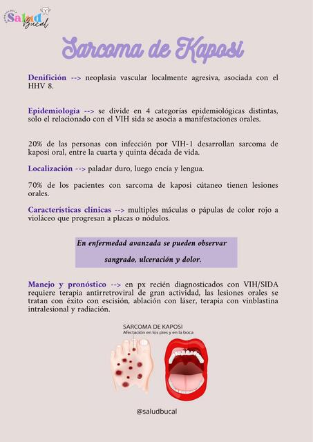 Sarcoma de Kaposi | Salud bucal | uDocz