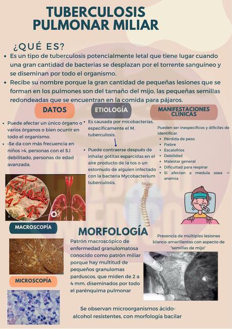 Tuberculosis Pulmonar Miliar | @CUIDADO.MEDICO | uDocz