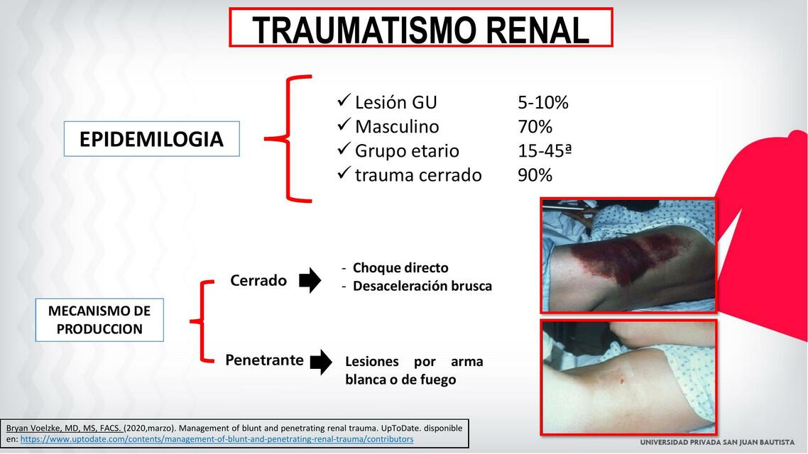 TRAUMA RENAL | Ediv OC | uDocz