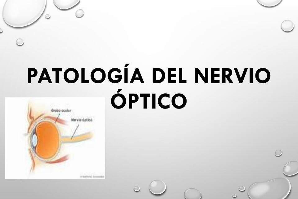 Patología del Nervio Óptico | Dra Monito | uDocz