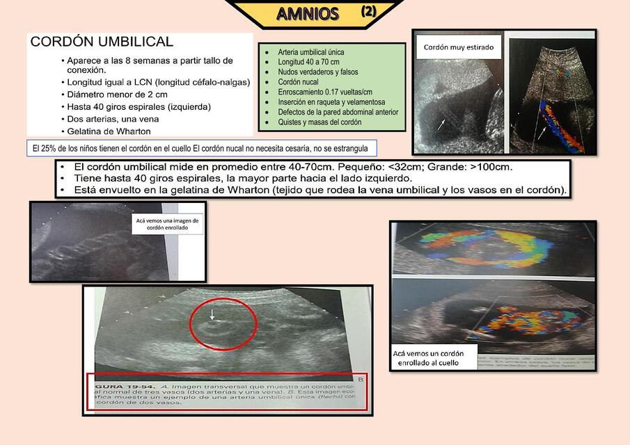 Amnios Cordón umbilical | Mishelle Chavez | uDocz