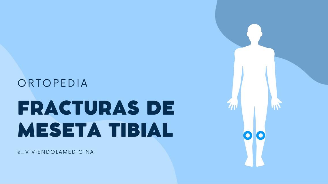 Fractura de Meseta Tibial | Viviendo la medicina | uDocz