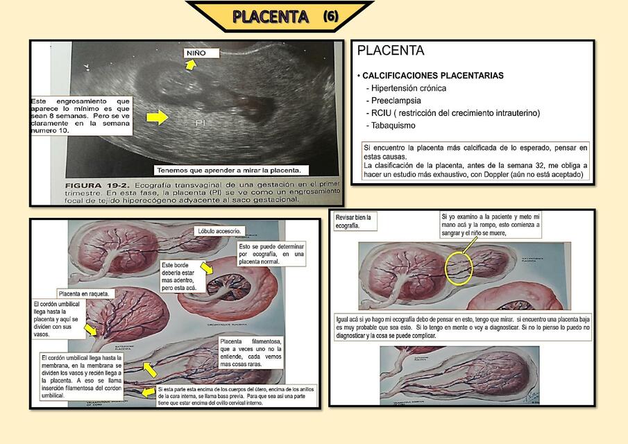 Placenta Anatomía | Mishelle Chavez | uDocz