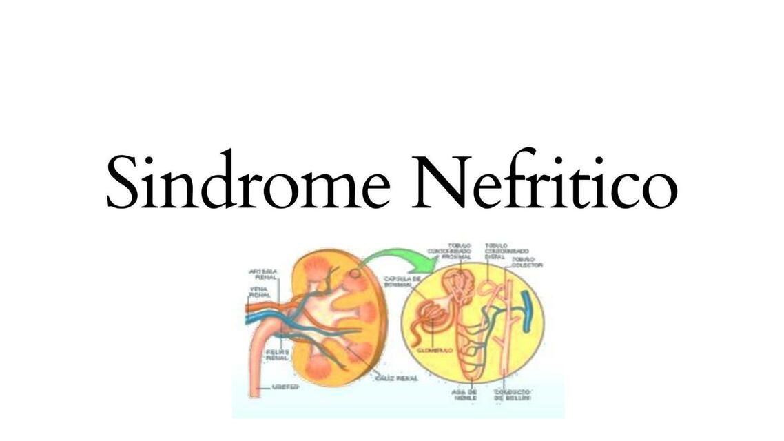 Sindrome Nefritico | Ediluis | uDocz
