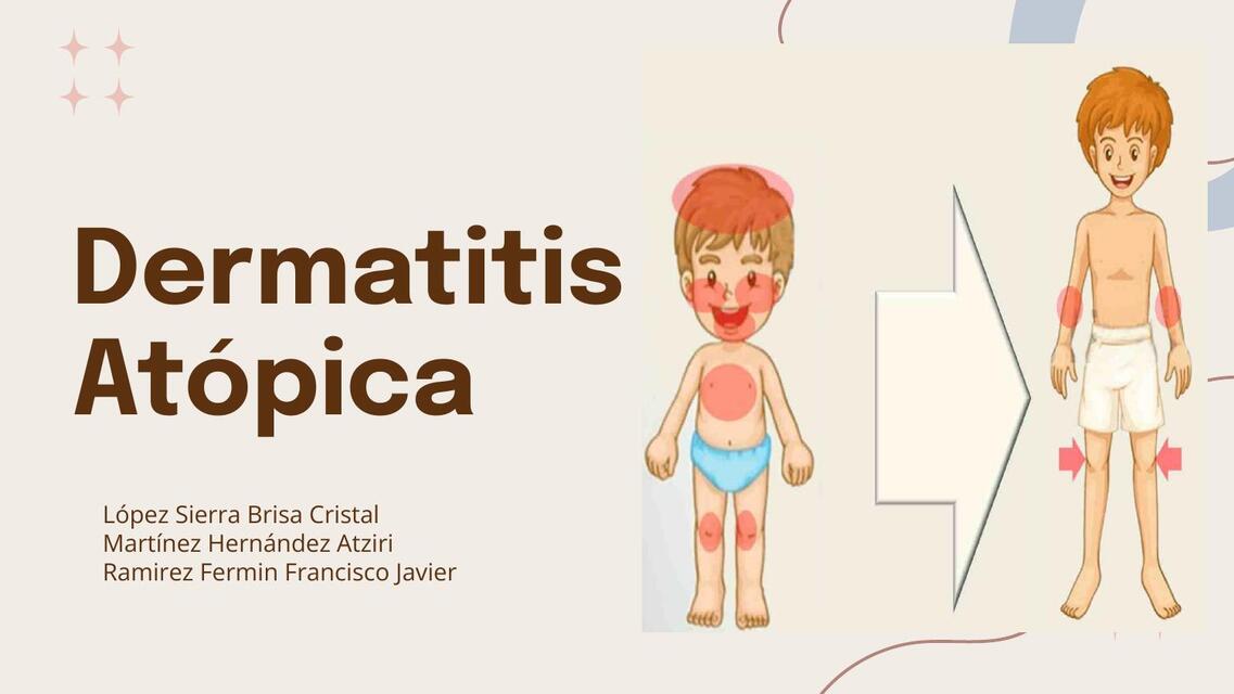 Dermatitis Atópica | Atziri Martinez | uDocz