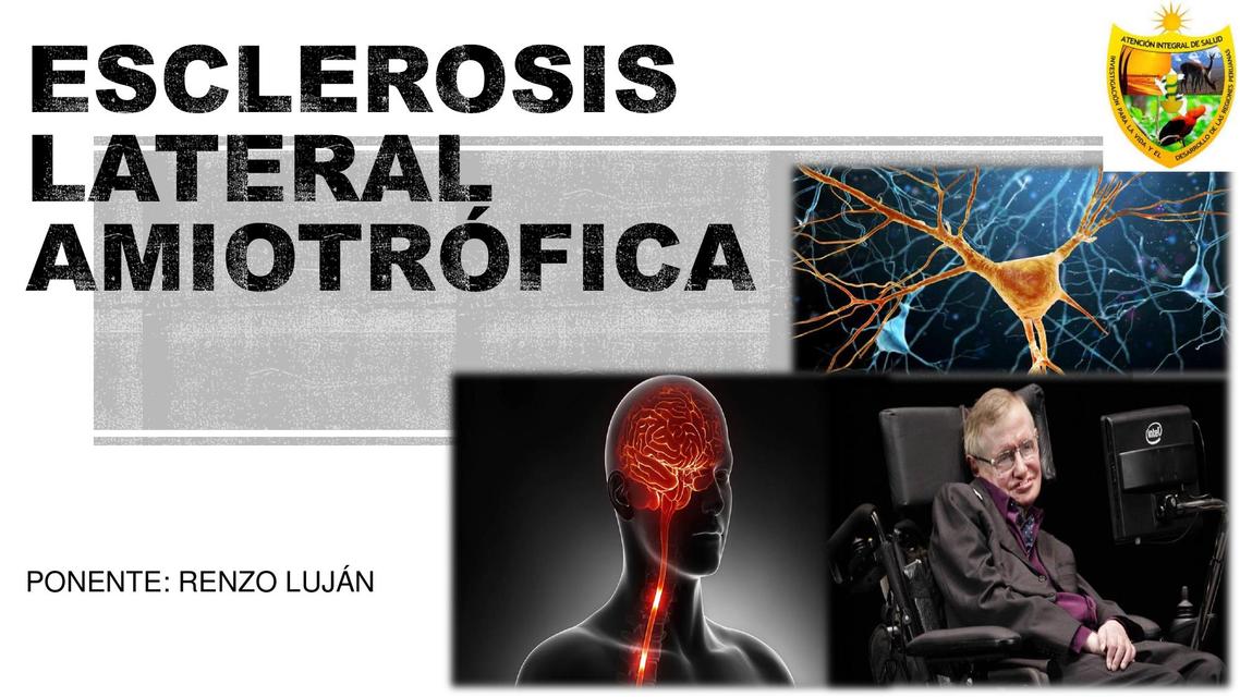 ESCLEROSIS LATERAL AMIOTRÓFICA | Renzo Luján | uDocz