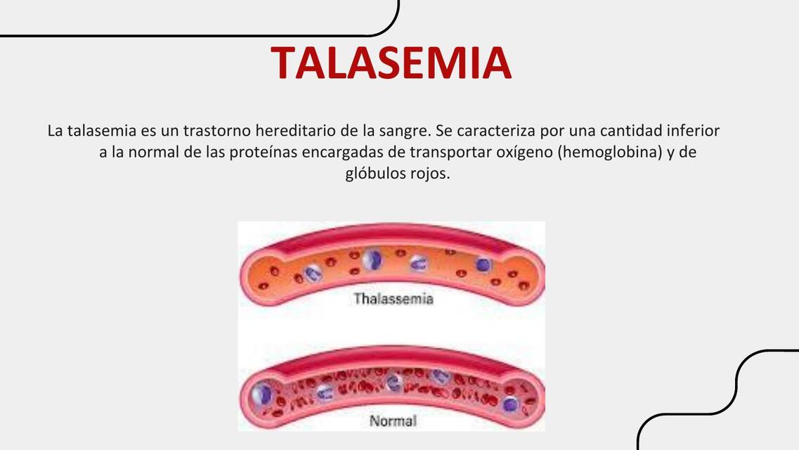 Talasemia | Etienne Rivero | uDocz