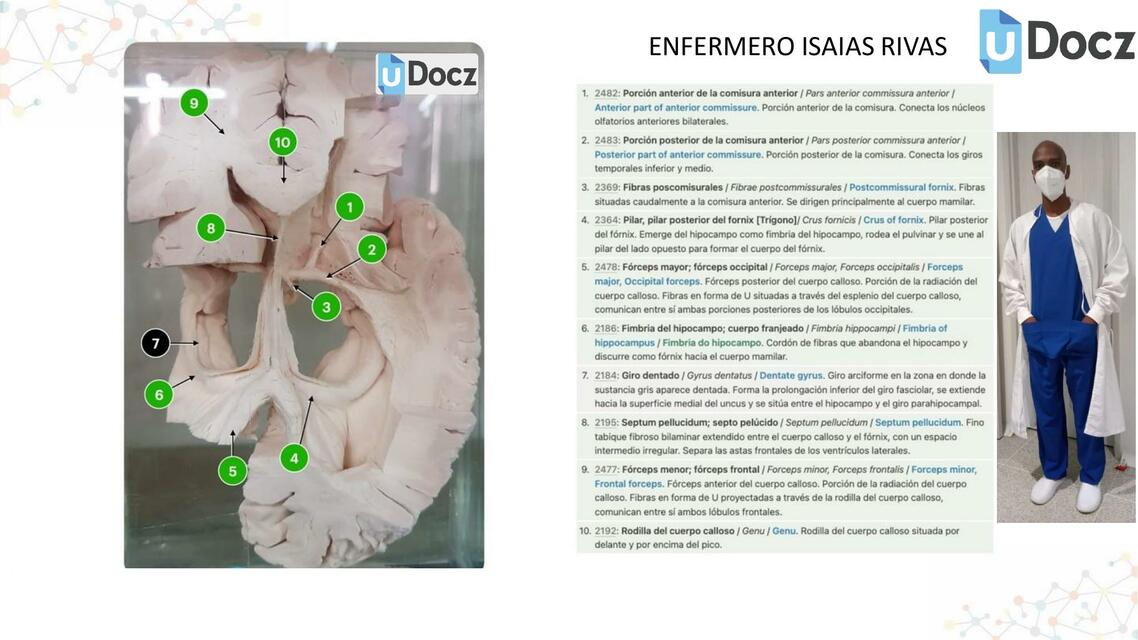 Vista superior del telencéfalo y sus fibras blancas. | Enfermero Isaias ...