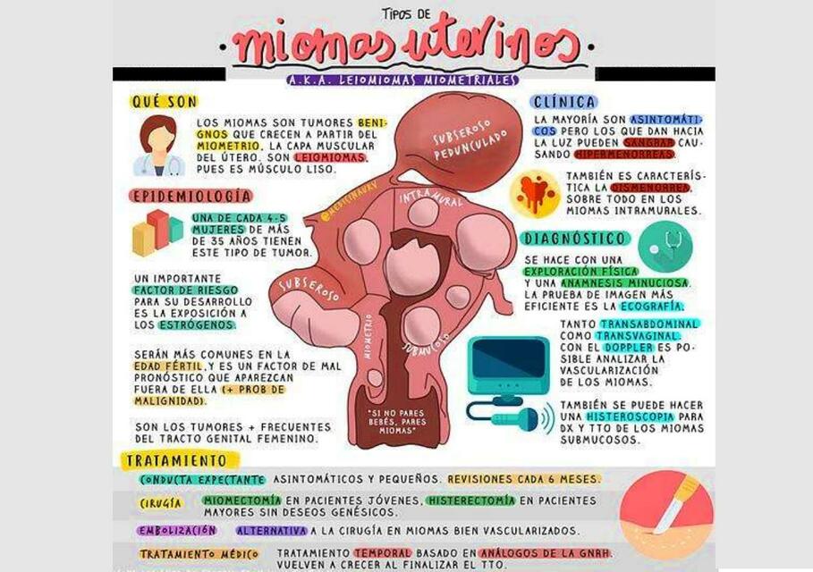 Tipos de miomas uterinos | fraii | uDocz