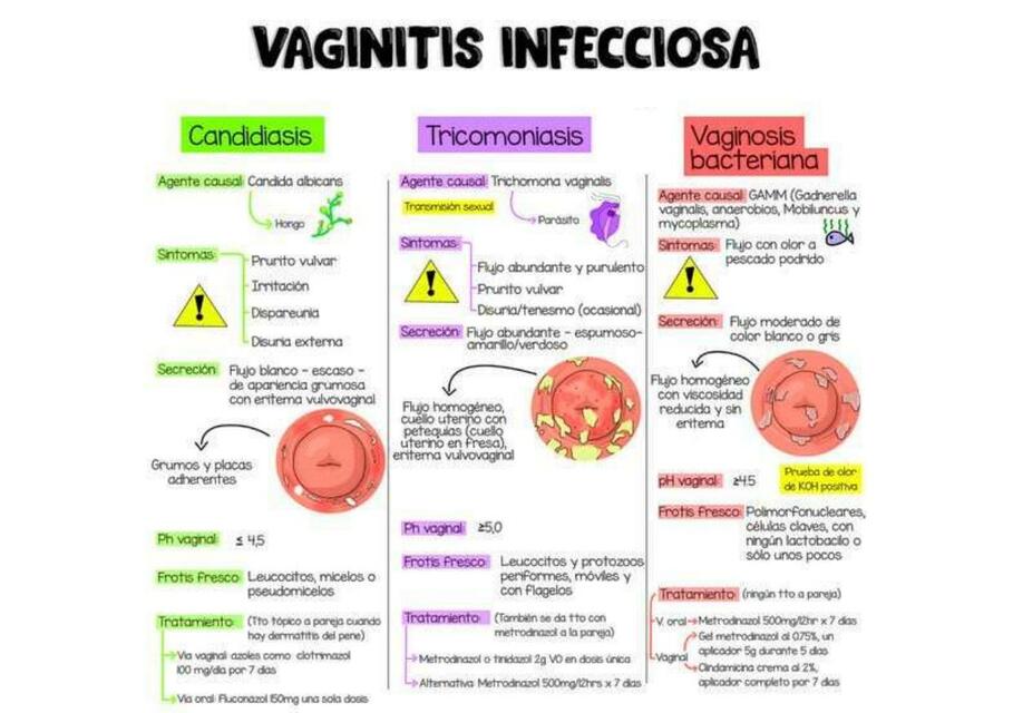 Vaginitis infecciosa | fraii | uDocz