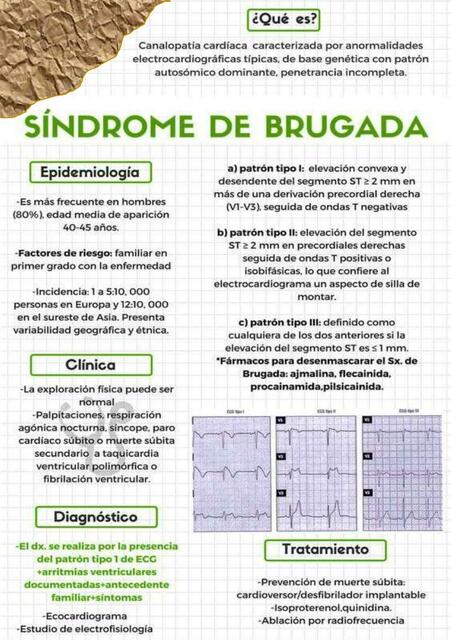 Síndrome de brugada | fraii | uDocz