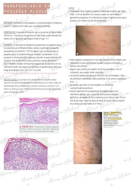 PARAPSORIASIS EN PEQUENAS PLACAS | Abigail Menor Ibañez | uDocz