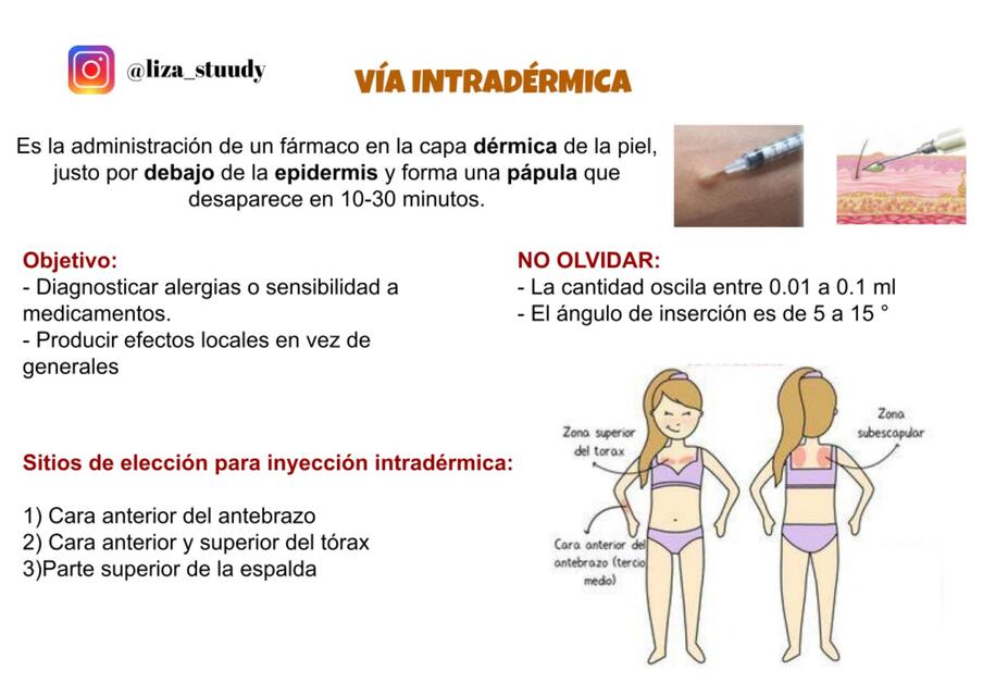 Vía Intradérmica | Liza Stuudio | uDocz