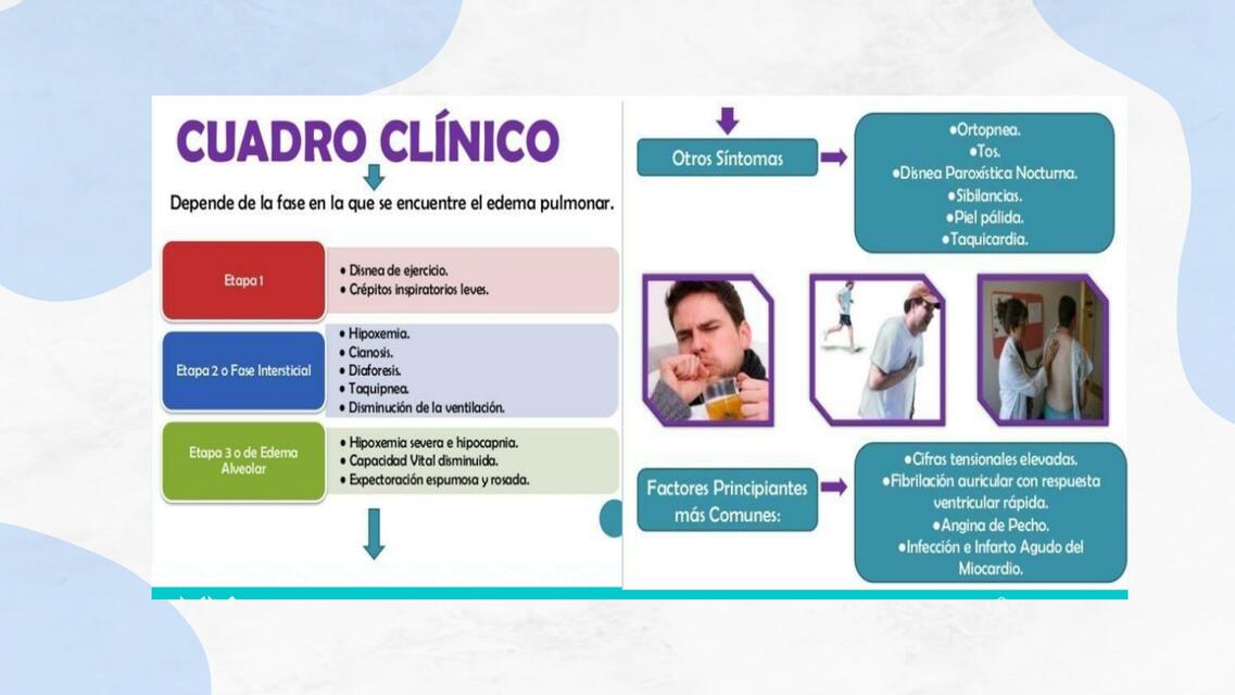 Edema Pulmonar Cuadro Clinico | Alxnsx s | uDocz