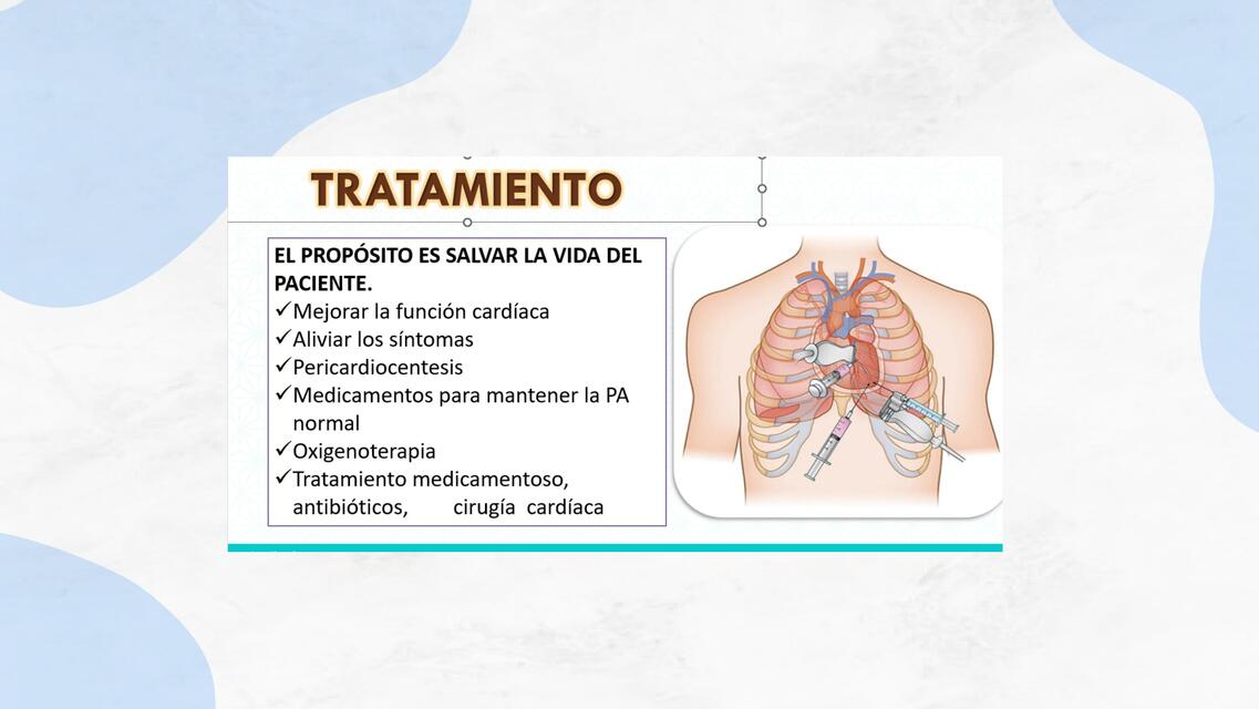 Tratamiento Triada de Beck | Alxnsx s | uDocz
