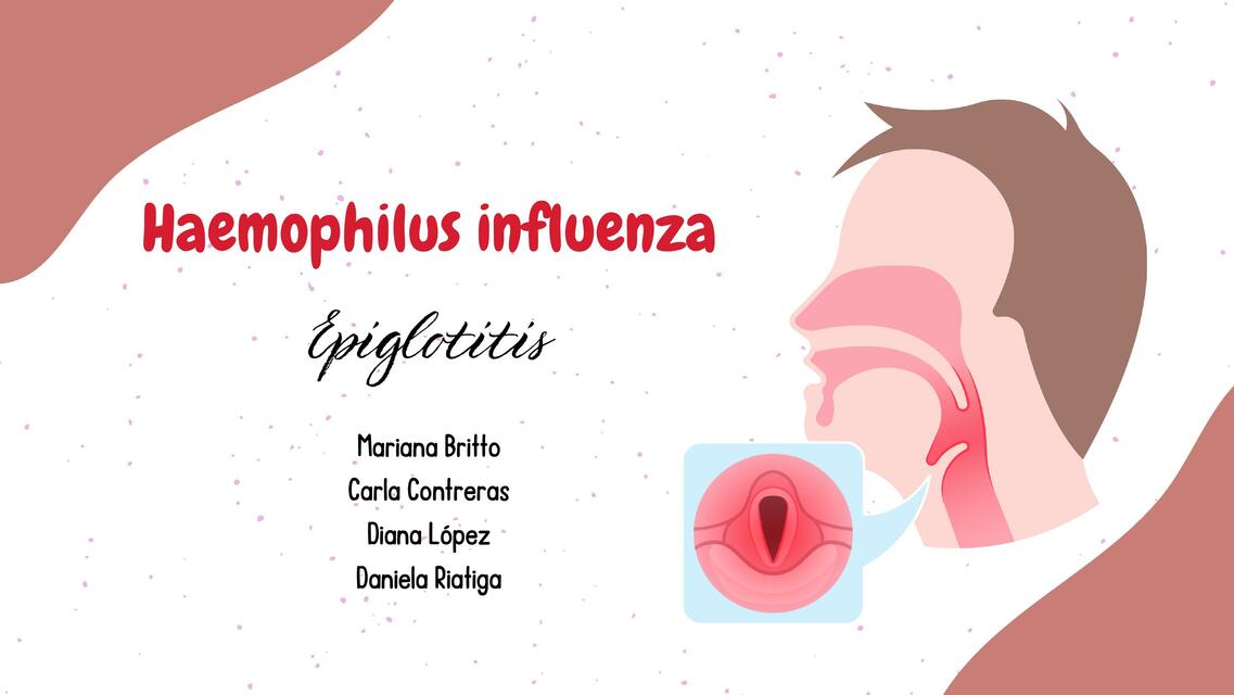 Haemophilus influenzae | Mariana Brito Contreras | uDocz