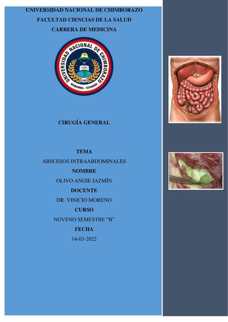 Abscesos intra abdominales | Jose Guaman | uDocz