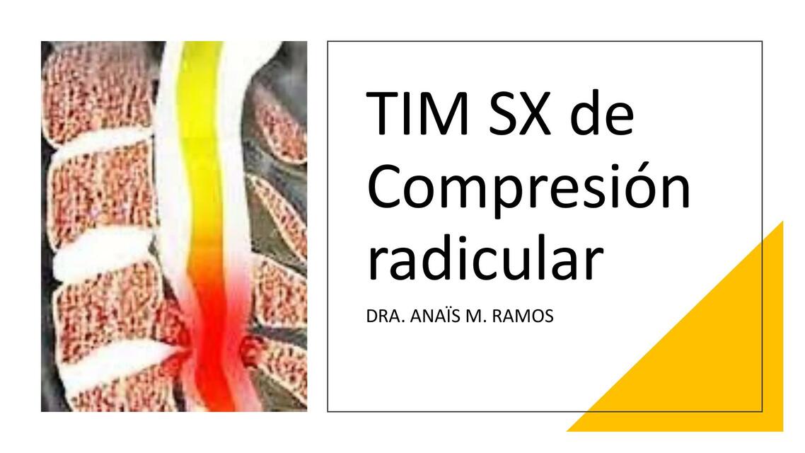 Tim sx de compresión radicular | Jackeline_ Barrigagarcia | uDocz