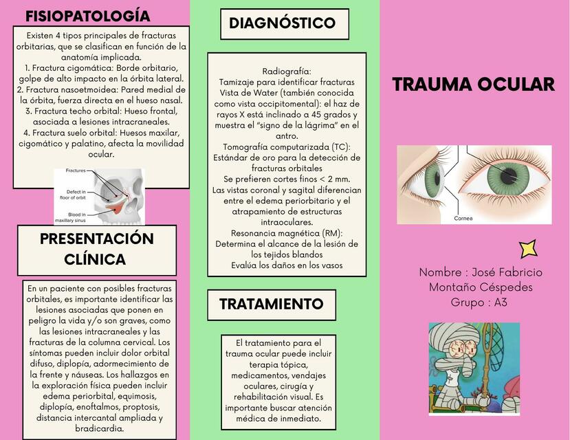 Trauma ocular | José Fabricio Montaño Céspedes | uDocz