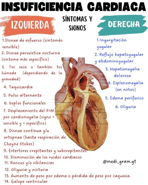 Insuficiencia Cardiaca Signos Sintomas Insuficiencia Cardiaca | My XXX ...