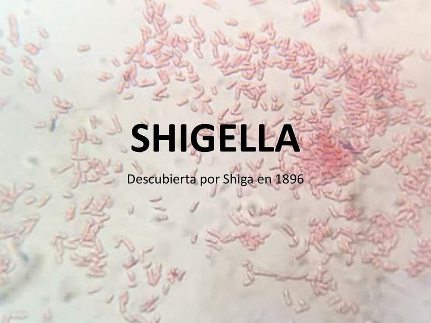 Shigella | Daniela Conde | uDocz