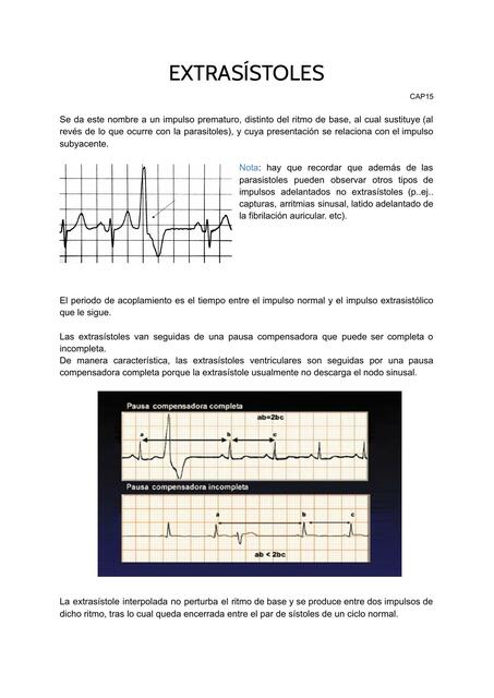 Extrasístoles | Estrellita Martínez | uDocz