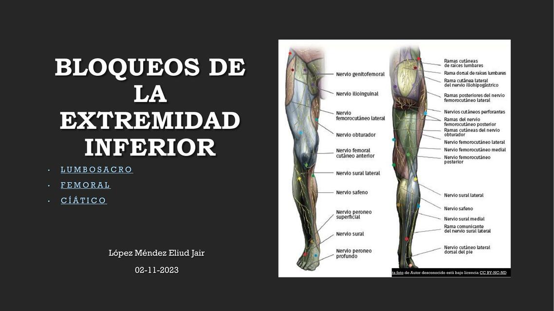 Bloqueos de la extremidad inferior | ELIUD JAIR LOPEZ MENDEZ | uDocz