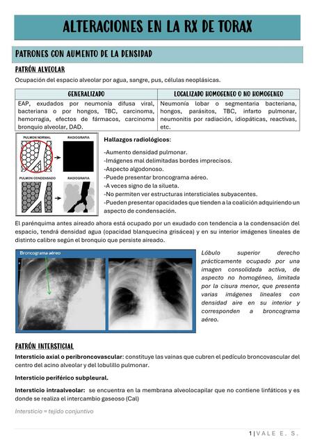 ALTERACIONES EN LA RX DE TORAX | ValeES25 | uDocz