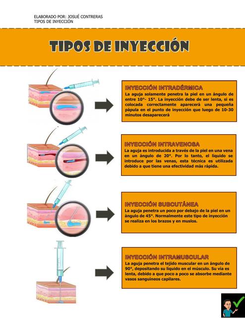 TIPOS DE INYECCIÓN | Josué Contreras | uDocz