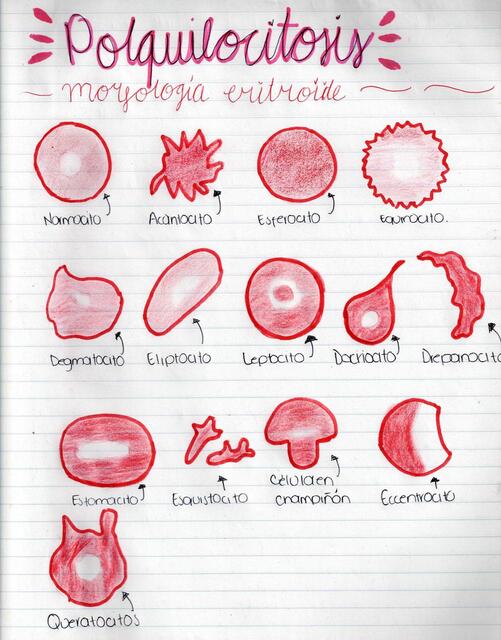 Poiquilocitosis | Ranita Cientifica | uDocz