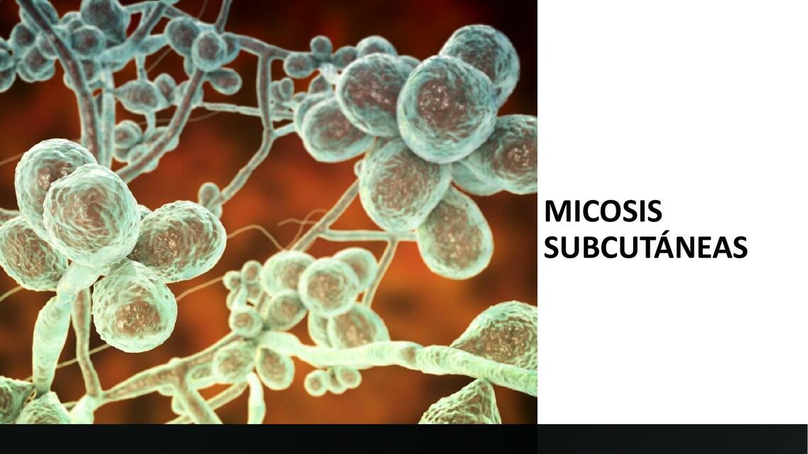 Micosis subcutáneas | Javier Torres | uDocz