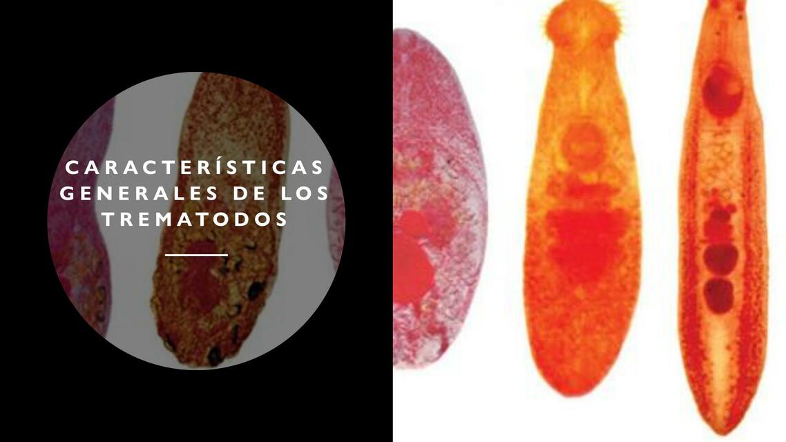 Características generales de las trematodos | Javier Torres | uDocz