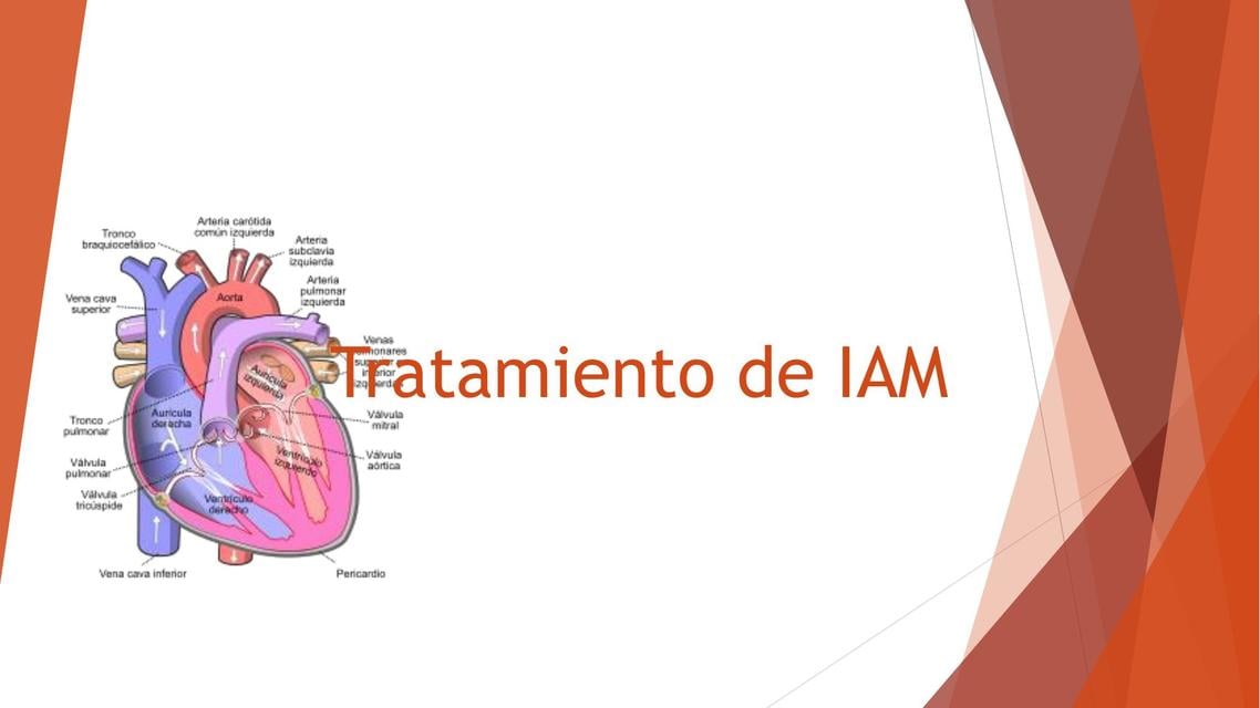 Tratamiento de IAM | FitMed | uDocz