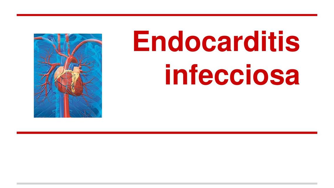 endocarditis infecciosa | FitMed | uDocz