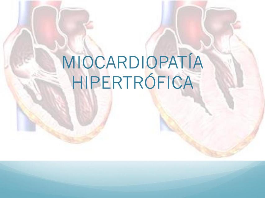 Flashcards de Cardiomiopatia Hipertrofica | Por FitMed | uDocz