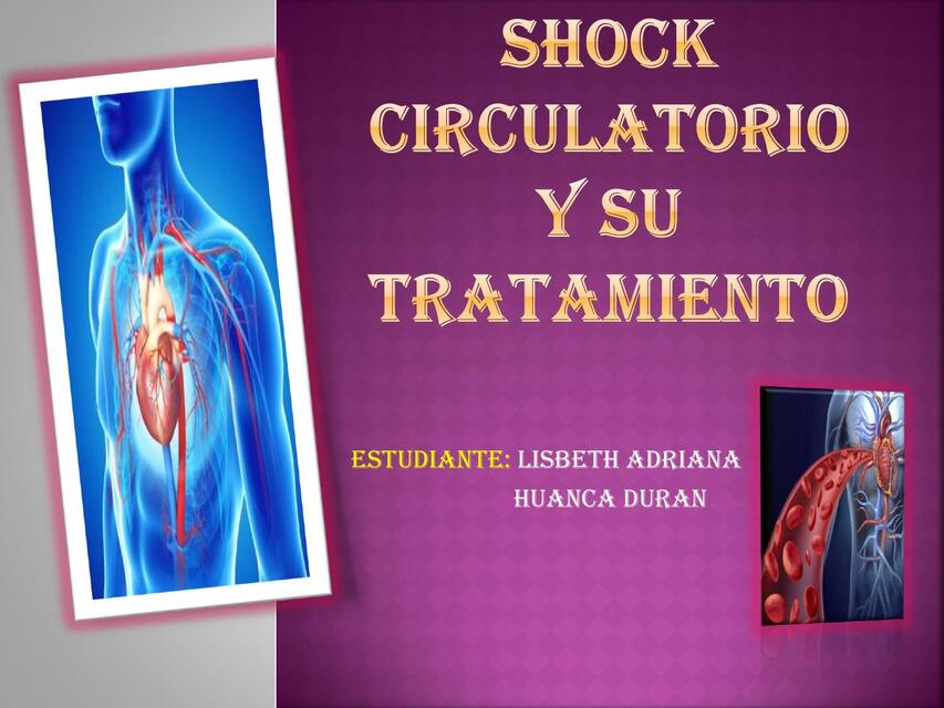 Shock circulatorio y su tratamiento | Dayana Lopez | uDocz
