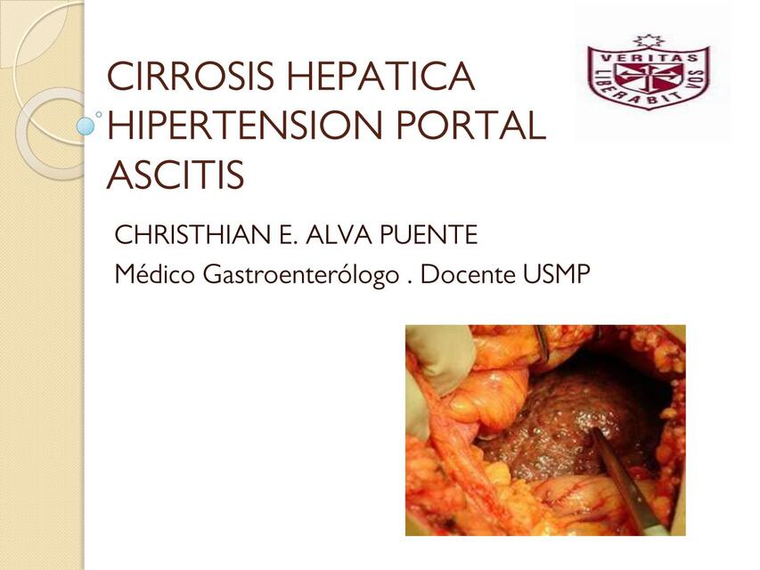 Cirrosis hepática hipertensión portal ascitis | Junior M. Guevara | uDocz