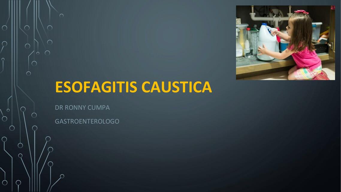 Esofagitis caustica | Junior M. Guevara | uDocz