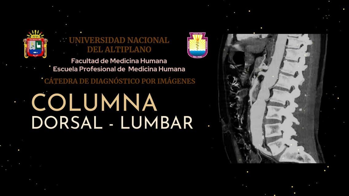 TC Columna dorsal y lumbar | SINTIA TATIANA - Medyversos | uDocz