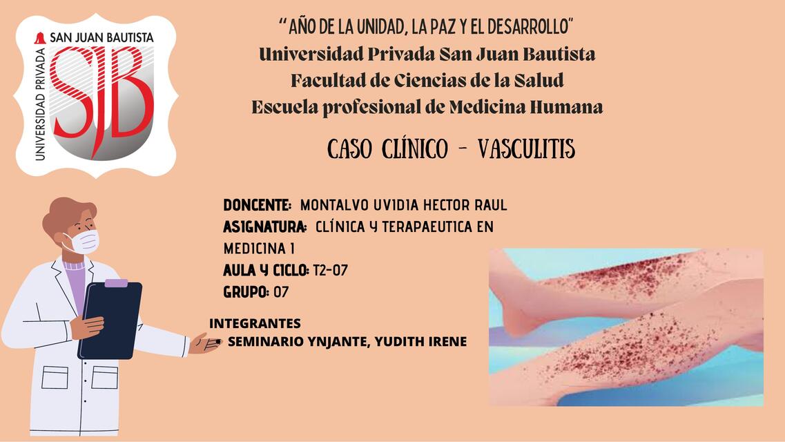 Vasculitis | yudith irene seminario injante | uDocz